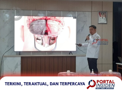 RS Hasri Ainun Habibie Parepare Sukses Lakukan Operasi Bedah Otak ...